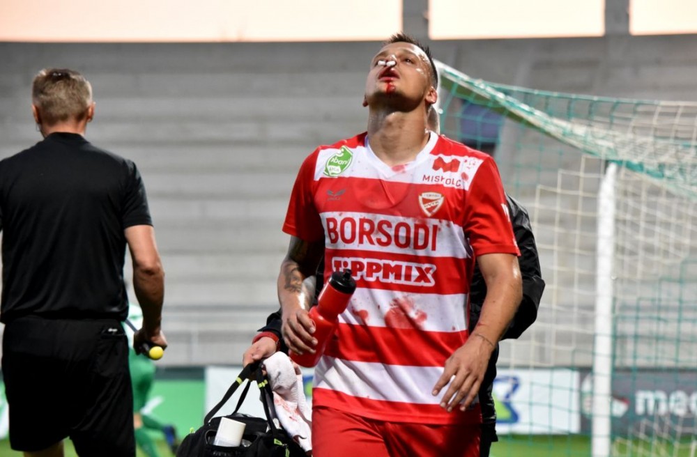 Mirko Ivanovski: orrcsonttörés - Amíg Élek Én